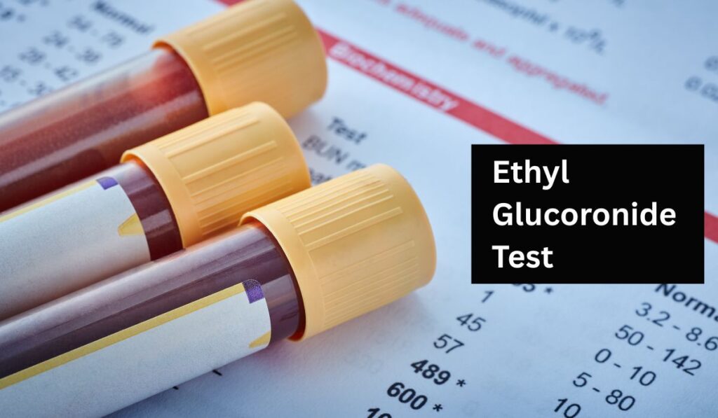 What Is A Ethyl Glucoronide Test