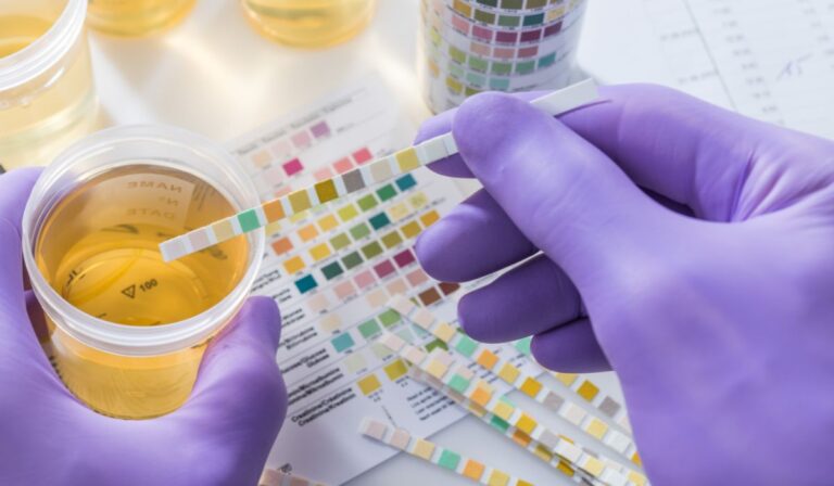 Does Alprazolam Show Up in a Drug Test?